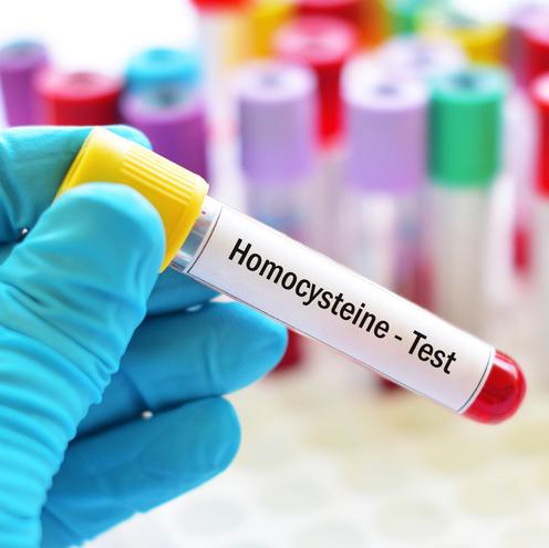 What is Homocysteine? | Healthful Elements